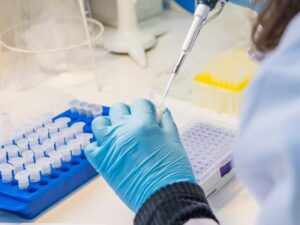 What is an EP Tube (Eppendorf Tubes)? How to Fill Them Efficiently-SFXB ...